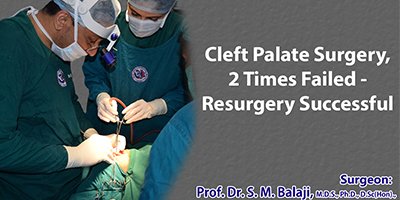 Dr SM Balaji is a world renowned cleft lip and palate surgeon