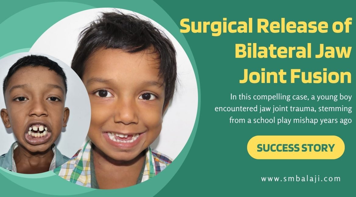 Jaw Reconstruction Surgery | Balaji Dental and Craniofacial Hospital